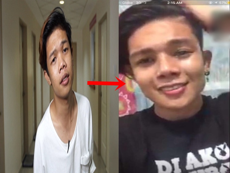 Marlou Arizala Allegedly Exposed His New Face After Surgery