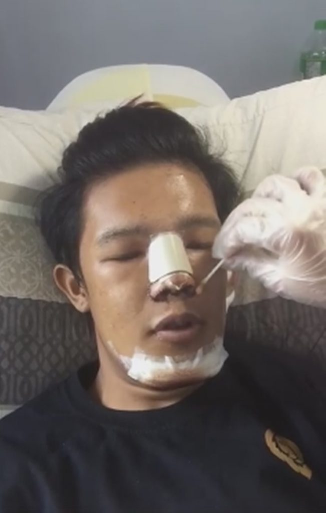 Marlou Arizala Finally Uploads Official Video Of Recovering Face After ...