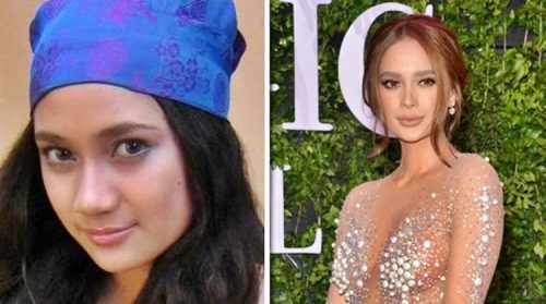 Celebrities Admits To Have Undergone Cosmetic Surgery