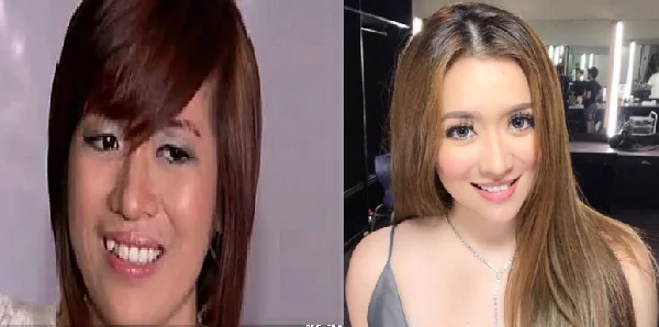 Filipino Celebrities' Shocking Transformation After Fame