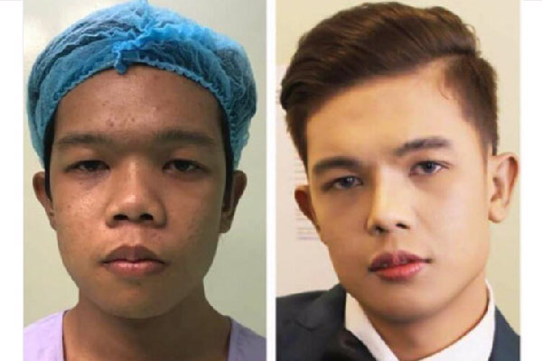 MUST WATCH: Xander Ford Undergoes Face Reading (VIDEO)