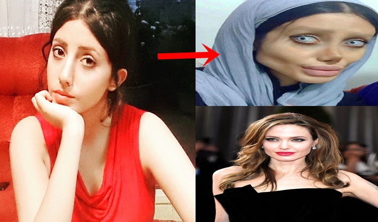19-Year-Old Woman Undergoes Over 50 Cosmetic Procedures To Look Like ...