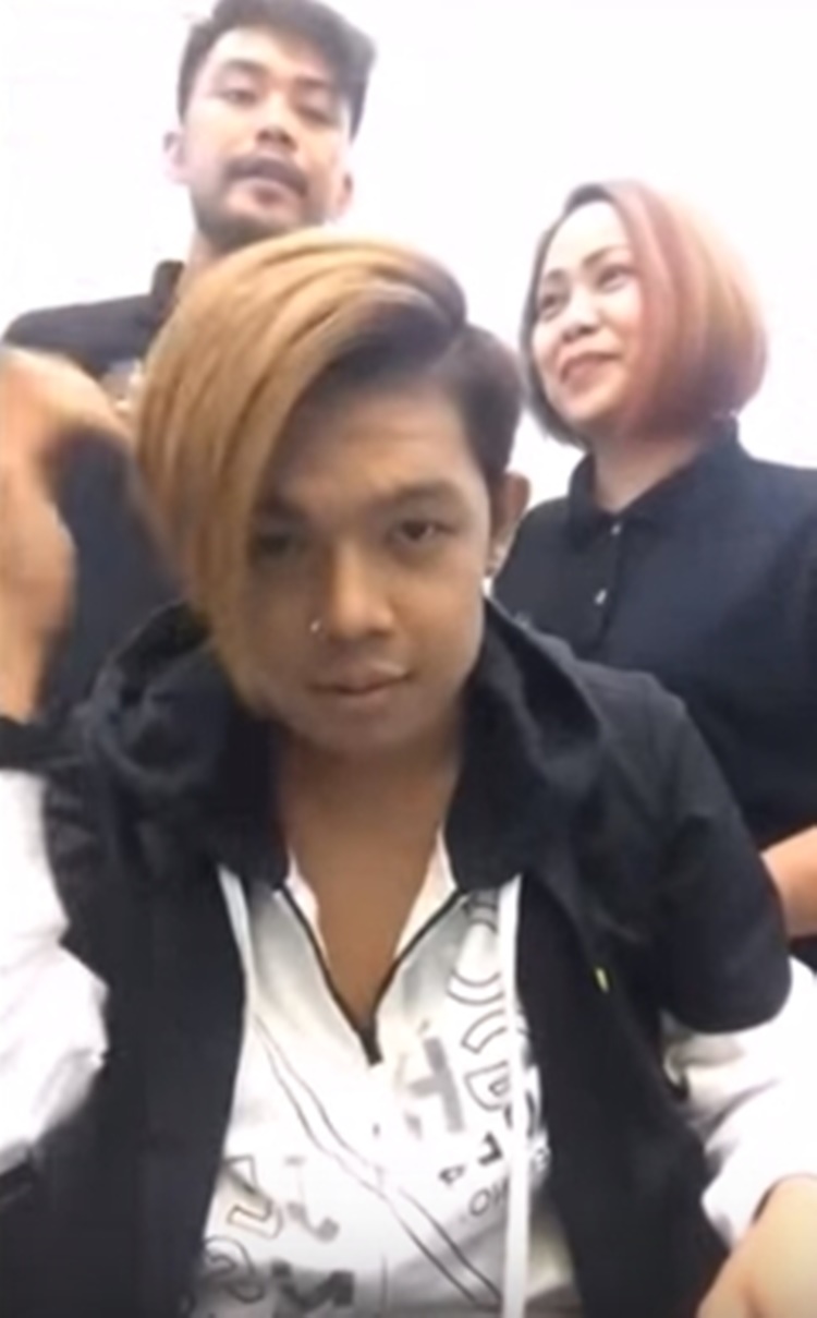 Xander Ford’s Face Began To Return On Its Original Form Few Months ...
