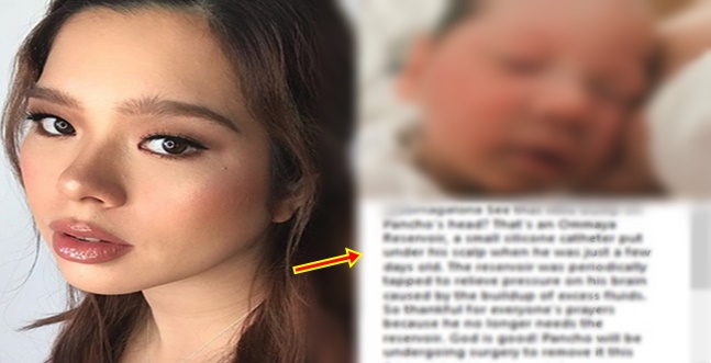 Saab Magalona's Baby 'Pancho' To Undergo Surgery