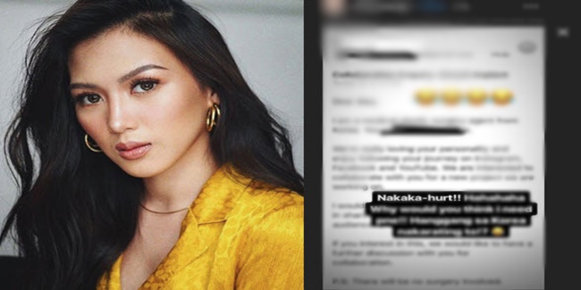 Alex Gonzaga Receives Plastic Surgery Offer From Korea, Vlogger React