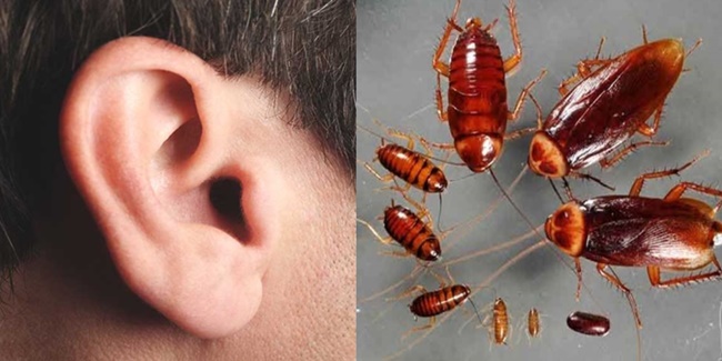 Family Of Cockroaches Found Crawling Inside Man's Ear