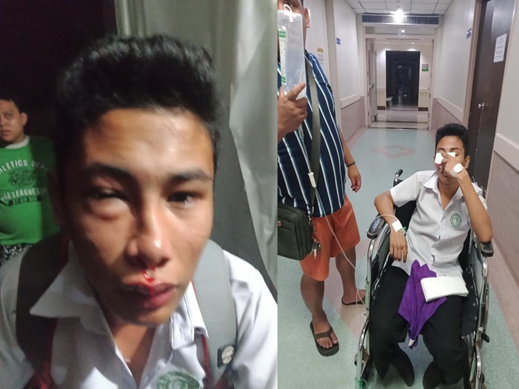 Raging Mom Slams Bullies After Bullying & Mauling Her PWD Son