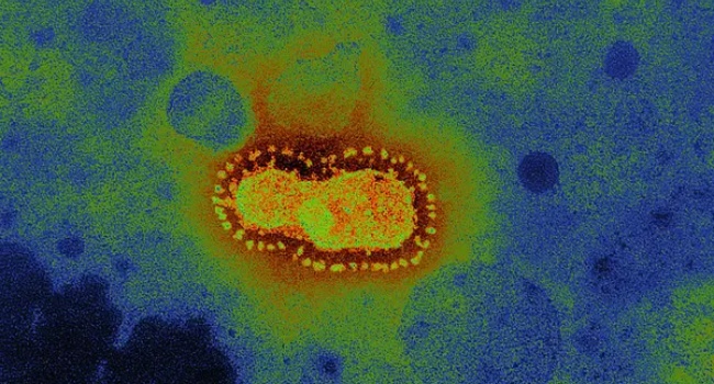 Virus Simulation Kills 65 Million People In 18 Months - Scientist