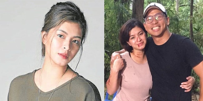 Angel Locsin: Director Reveals How Actress Saved Stuntman's Life