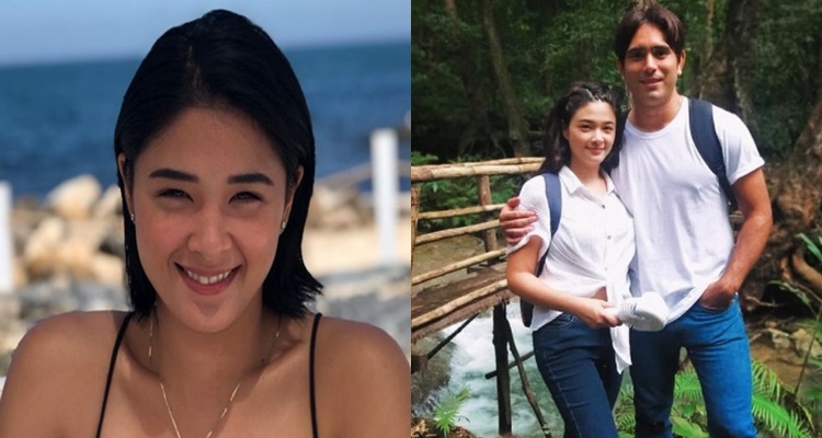Yam Concepcion Speaks About Doing Intimate Scenes Before & Now
