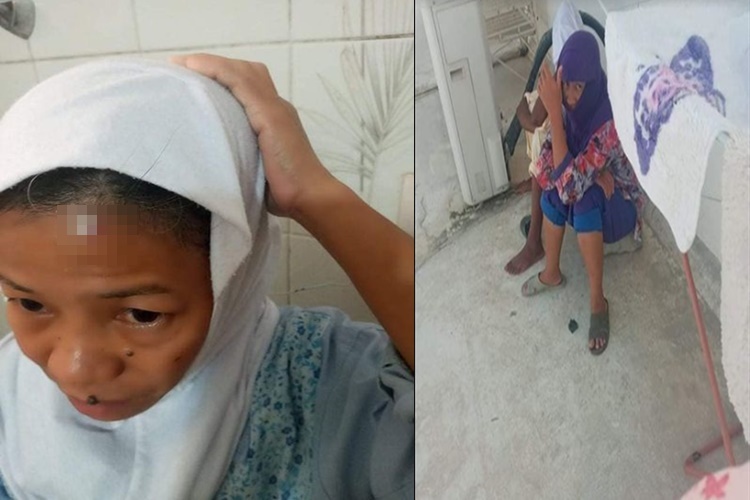 Pinay OFW Seeks Help After Suffering Abuse from Employer’s Hand