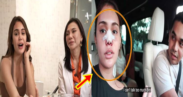 Ivana Alawi Undergoes Nose Restructuring? This Is Her Family's Reaction