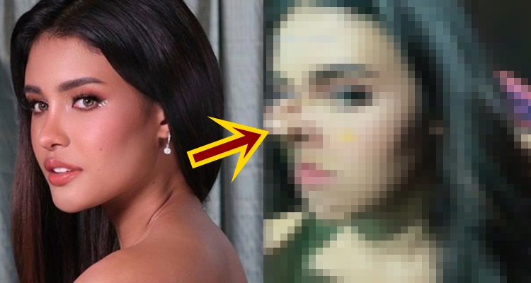 Rabiya Mateo Ends Nose Job Rumors By Doing This