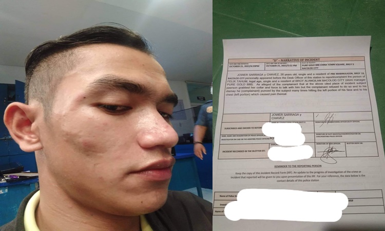 Puregold Employee Files Complaint vs Store Manager Who Punched Him