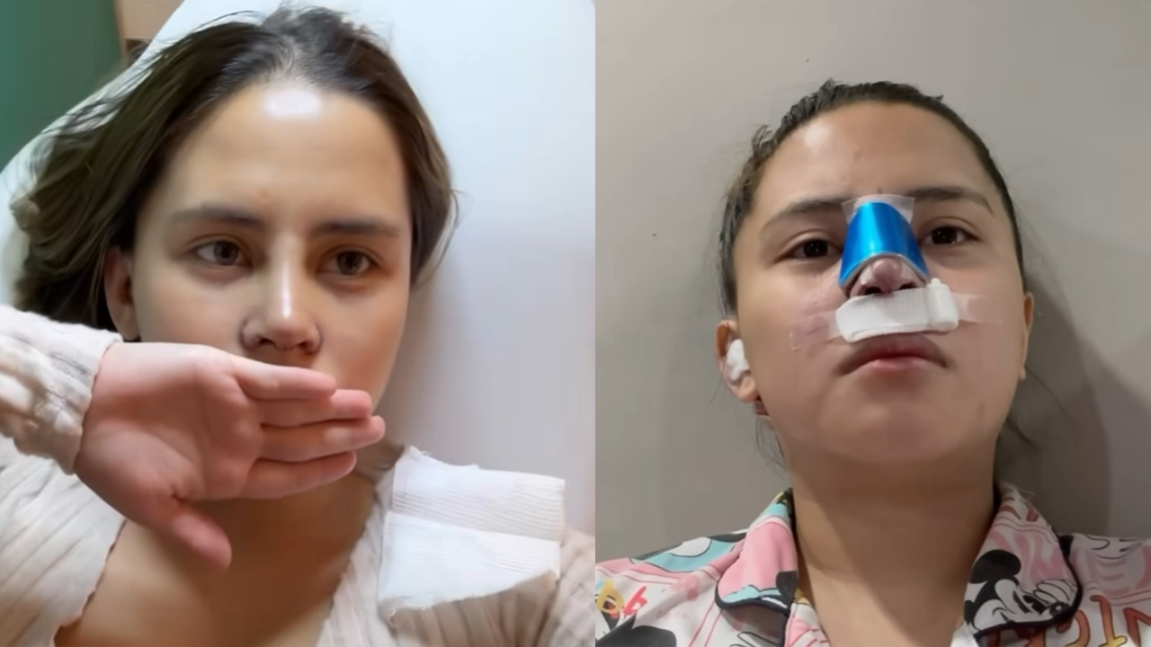 Antonette Gail on Critisms of Her Nose Job: “Katawan ko to!”