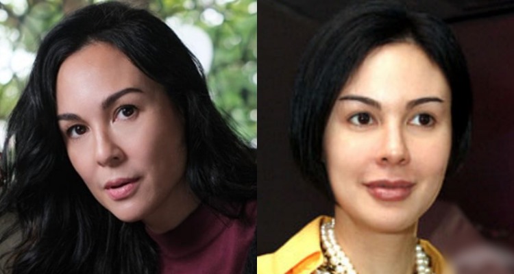 Gretchen Barretto Recalls "Like a fish" Comment For Her Lip Procedure ...