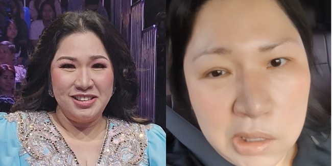 Frenchie Dy Opens Up About Her Bell's Palsy Battle & Shares Hopeful ...