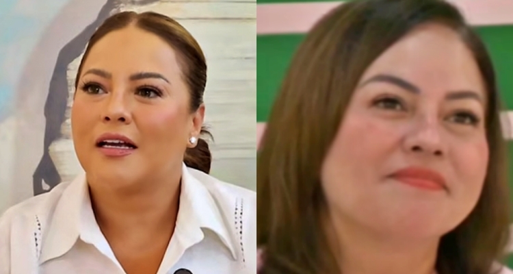Karla Estrada Replies To Comments About Her Face | PhilNews