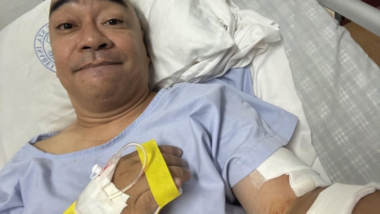 Wally Bayola Now Recovering After Motorcycle Accident | PhilNews